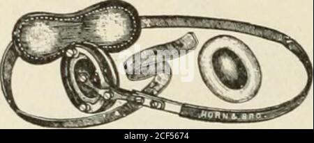 . Abdominal hernia : its diagnosis and treatment. 5. Radical-cure truss ...
