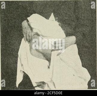 . Abdominal hernia : its diagnosis and treatment. Woman aged 40 years ...