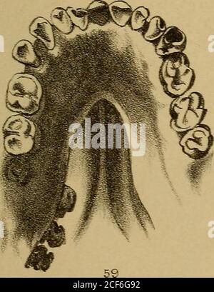 . Deformities of the mouth : congenital and acquired, with their ...