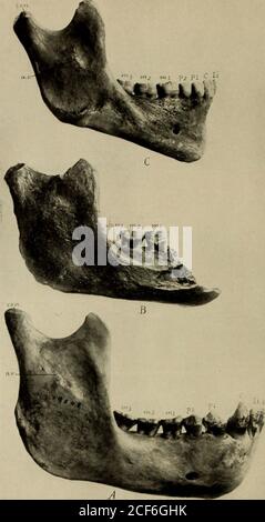 Fossil anthropoid teeth. Collection of fossil teeth from anthropoid ...