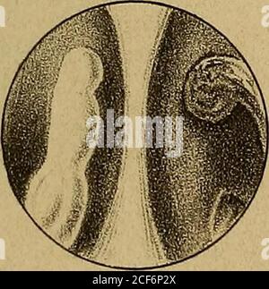 . Deformities of the mouth : congenital and acquired, with their ...