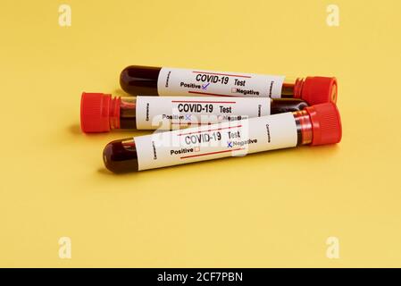 Closeup shot of positive and negative COVID-19 tests Stock Photo - Alamy