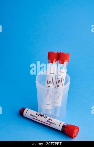 Closeup shot of laboratory plastic tubes used for coronavirus research ...
