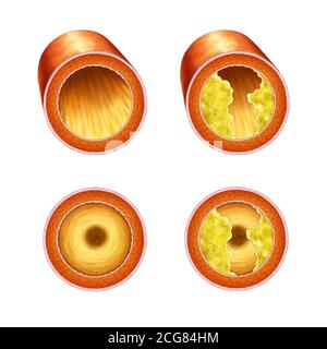 anatomical illustration of vascular cross section Stock Photo - Alamy