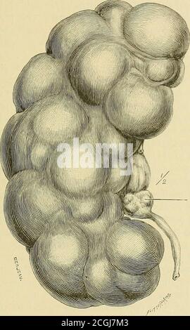 . On the origin and progress of renal surgery, with special reference ...