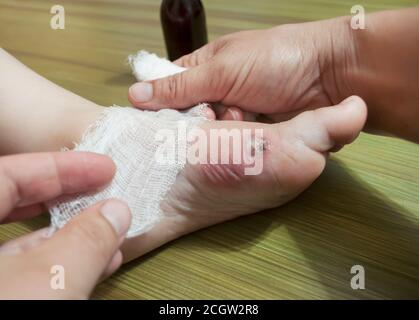 A woman aged 35-50 bandages a wound on the foot of a 5-year-old child ...