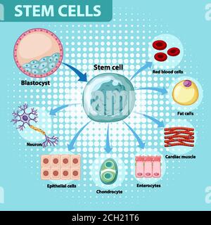 Information poster on human stem cells illustration Stock Vector Image ...
