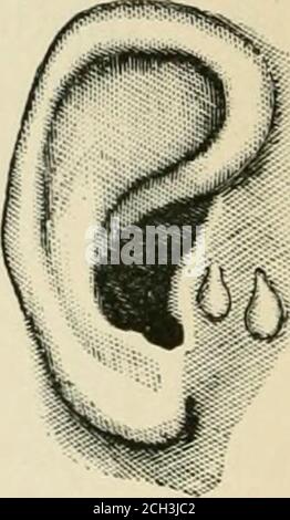 . Evolution and disease . an Ears with so-called supernumerary auricles ...