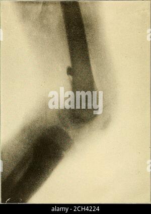 . Principles of electro-medicine, electrosurgery and radiology : a ...