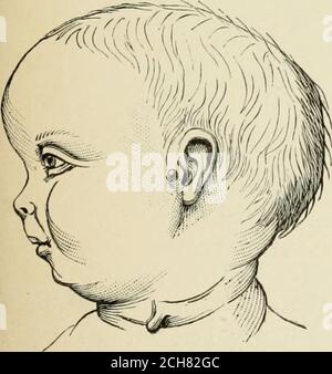 . Evolution and disease . an Ears with so-called supernumerary auricles ...