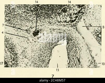 . The American journal of anatomy . JUGULAR LYMPH SAC(INJECTED ...