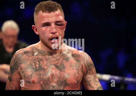 Sam Hyde with an eye injury as his fight against Richard Riakpohre is ...