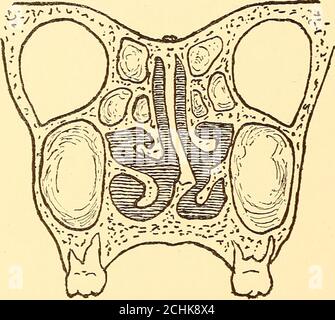 Diseases of the nose and throat . V. Fig. 76. Muscles of Soft Palate ...