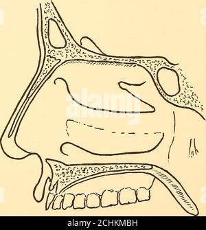 Diseases of the nose and throat . V. Fig. 76. Muscles of Soft Palate ...