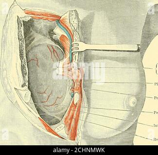 . Text-book of operative surgery . d turned upwards, the sterno ...