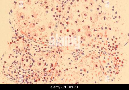 . The spleen and anæmia; experimental and clinical studies . o