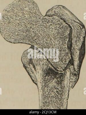 The principles of surgery . been restored, crepitus will beproduced by ...