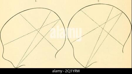 . The science and art of midwifery . -occipito-bregmatic. The OCCipito ...