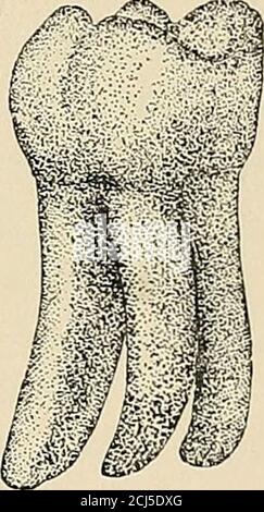 . Descriptive anatomy of the human teeth . e root is almost straight ...