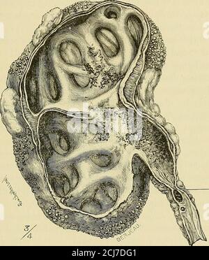 . On the origin and progress of renal surgery, with special reference ...