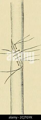 . On the origin and progress of renal surgery, with special reference ...