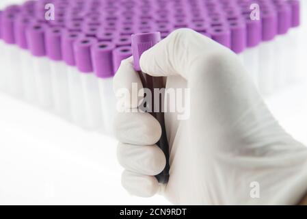 Vacutainer EDTA blood collection tubes Stock Photo - Alamy