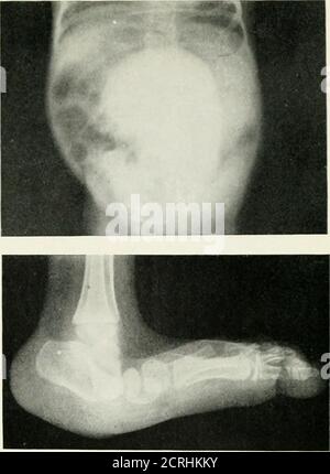 . Radiography, x-ray therapeutics and radium therapy . bercular disease ...