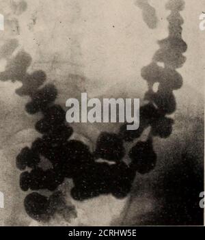 . Journal of radiology . POSITIONAL ANOMALIES OF THE INTESTINAL TRACT ...