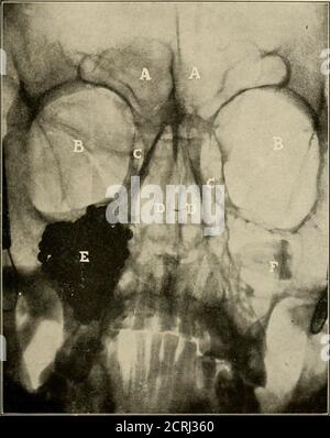 . Elementary and dental radiography . Fig. 274. Lateral view of the ...