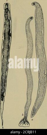 Oxyuris vermicularis female Stock Photo - Alamy