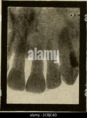 . Elementary and dental radiography . Fig. 201 Fig. 201 Fig. 200 ...