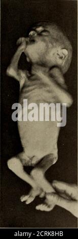 . Living anatomy and pathology; . FIG. 2 Stock Photo - Alamy