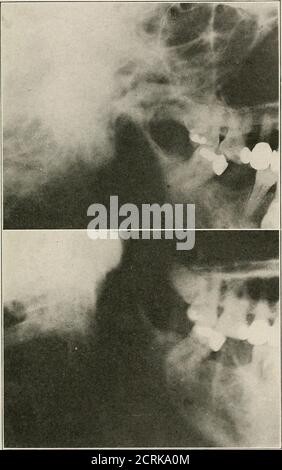 . Interpretation of dental and maxillary roentgenograms . of its ...