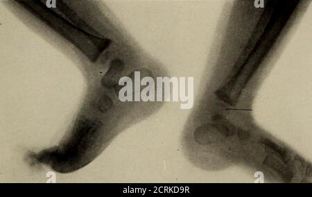 . Living anatomy and pathology; . PLATE 59.DOUBLE CONGENITAL ...