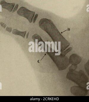 . Living anatomy and pathology; . FIG. A. FIG. 5.. FIG. 6 Stock Photo ...