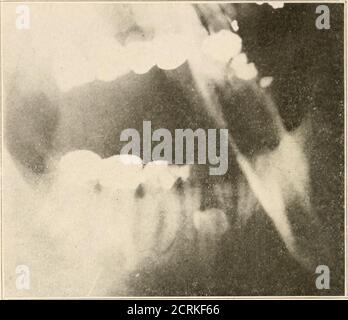 . Interpretation of dental and maxillary roentgenograms . of its ...