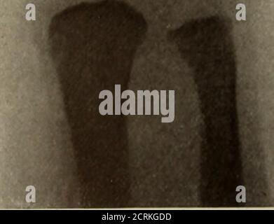 . Living anatomy and pathology; . PLATE 51.CONGENITAL DEFORMITY OF ...