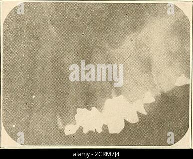 . Interpretation of dental & maxillary roentgenograms . ^m 1 *» H I Fig ...