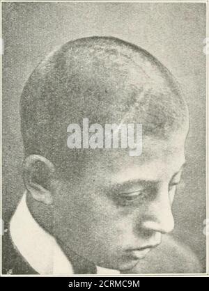 . Roentgen diagnosis of diseases of the head . Fig. 13 ...