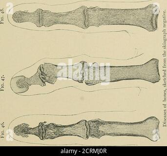 . Radiotherapy and phototherapy : including radium and high-frequency ...