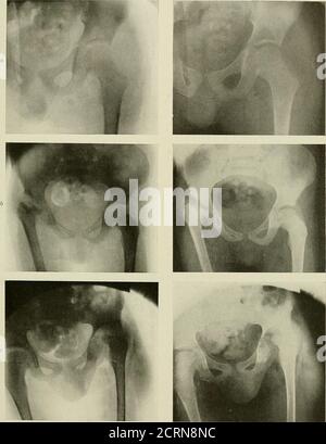 . Radiography and radio-therapeutics . s often not full of fine detail ...