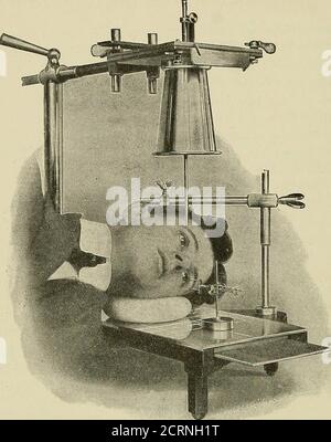 . Radiography and radio-therapeutics . Fig. 148,—Sweet localiser ...