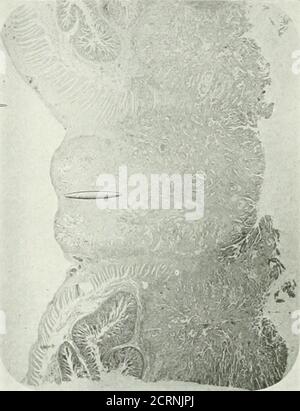 Distal Stomach and Duodenum Stock Photo - Alamy