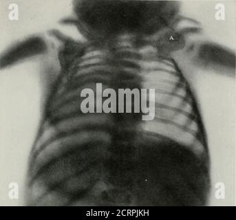 . Living anatomy and pathology; the diagnosis of diseases in early life ...