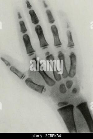 . Living anatomy and pathology; . PLATE 30.GROUP C. NORMAL. Girl, age 2 ...