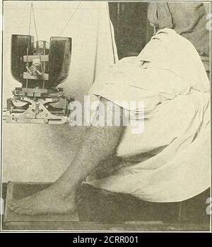 . The principles and practice of roentgenological technique . Fig. 237 ...