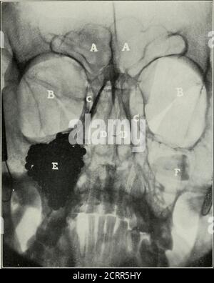 . Elementary and dental radiography . Fig. 274. Lateral view of the ...