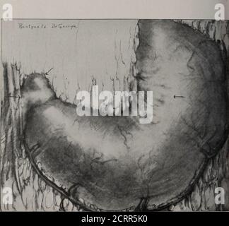 . American quarterly of roentgenology . Fig. 8. Diagrammatic ...
