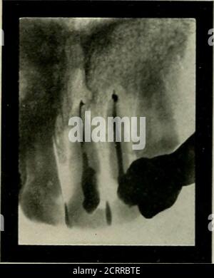 . Elementary and dental radiography . Fig. 300. Fig. 301. Fig. 300 ...
