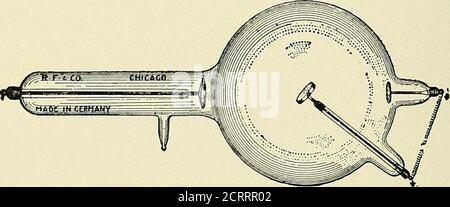 Metal in eye. X-ray of the face of a 64 year old male patient showing ...